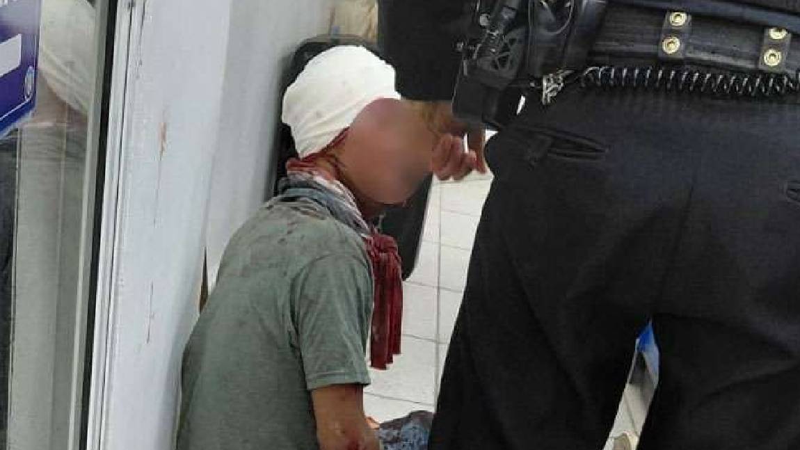 Atacan a machetazos a 3 personas en Chihuahua capital | ImpactoNoticias ...
